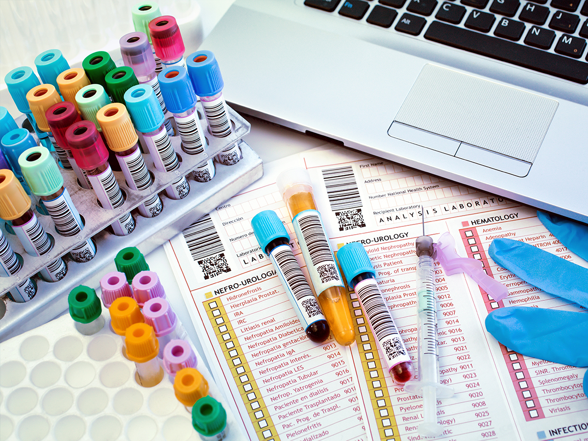 Preventing OR Specimen Errors - Action Products